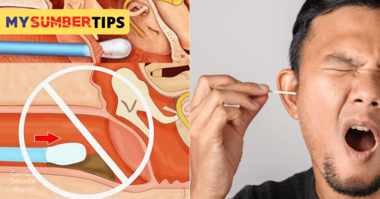 Bahaya Kalau Gunakan Cotton Bud Korek Telinga! Jadi, Gunakan 4 Cara Ni...